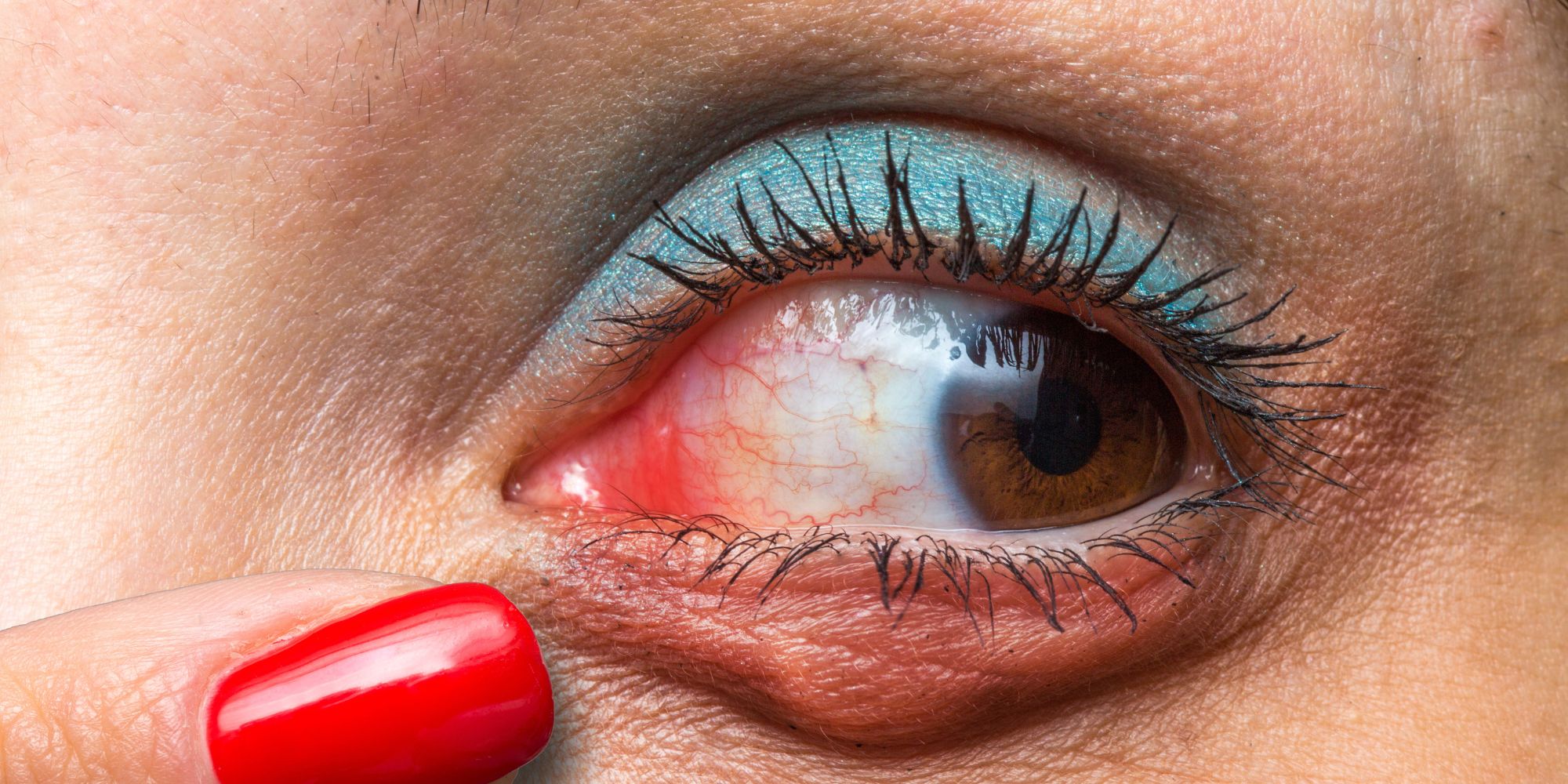 Ropiejące oczy u dziecka – o czym może świadczyć ropa w oku?