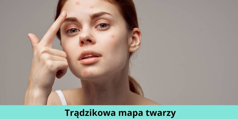 Trądzikowa mapa twarzy — o czym świadczą krosty i pryszcze?
