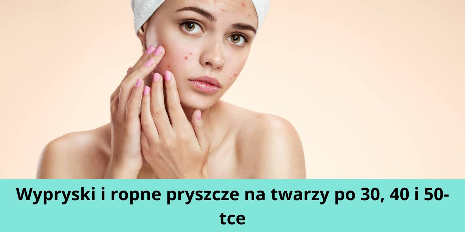 Wypryski i ropne pryszcze na twarzy po 30, 40 i 50-tce - przyczyny, leczenie