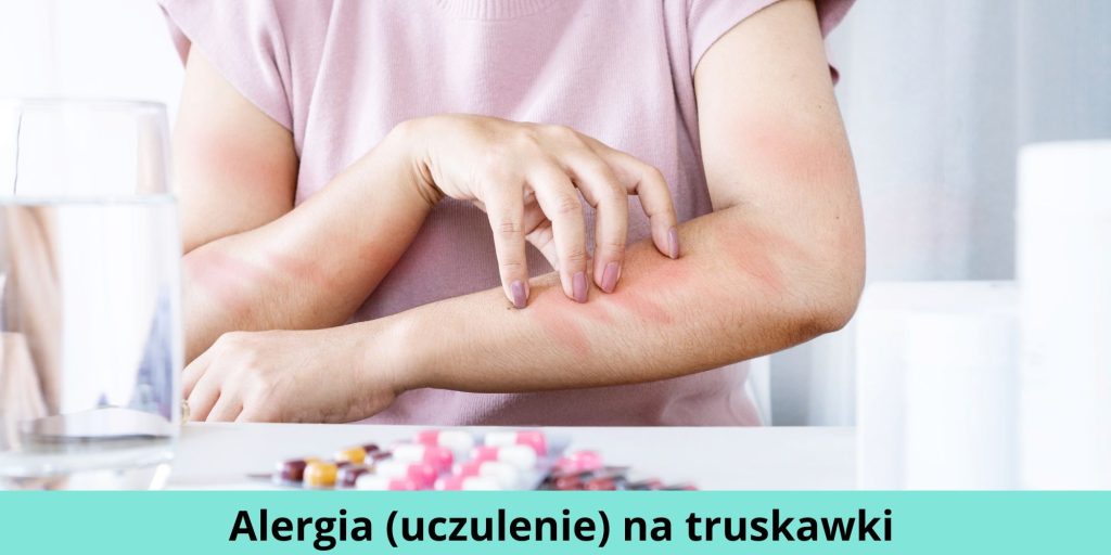 Alergia (uczulenie) na truskawki u dzieci i dorosłych - objawy, jak leczyć Alergia (uczulenie) na truskawki u dzieci i dorosłych - objawy, jak leczyć