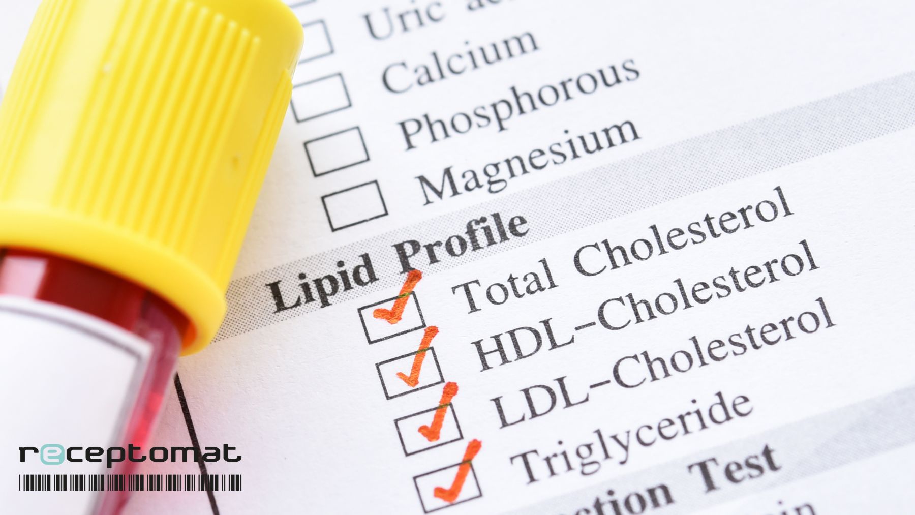 Lipidogram (profil lipidowy) - co to jest za badanie, wyniki, normy